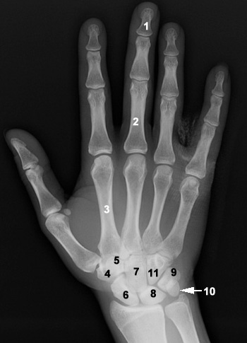 Bone Radiologic Anatomy