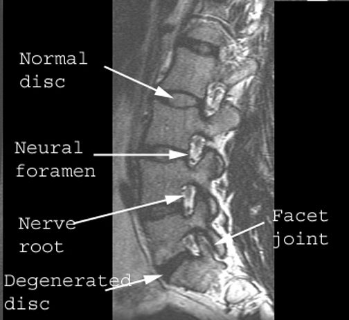 Bone Radiologic Anatomy