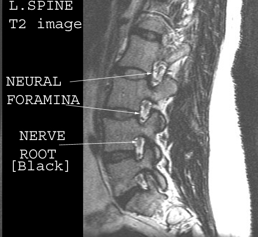 Bone Radiologic Anatomy