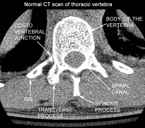 Bone Radiologic Anatomy