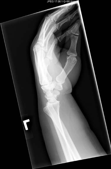 Bone Radiologic Anatomy