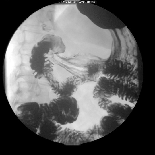GI and Abdomen Radiologic Anatomy