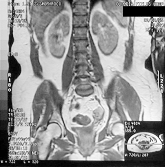 GU Radiologic Anatomy