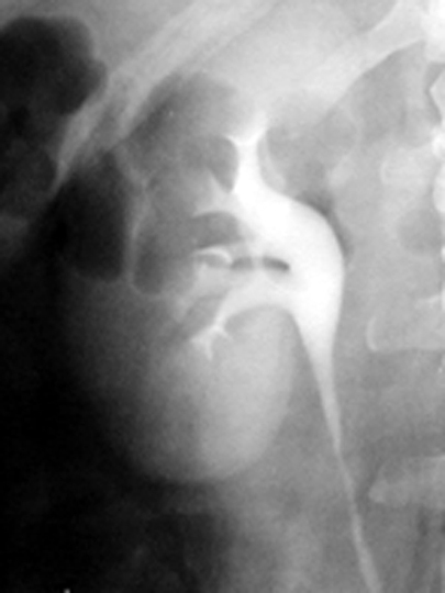GU Radiologic Anatomy