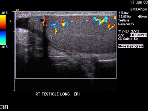 GU Radiologic Anatomy