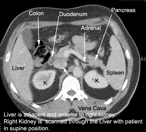 GU Radiologic Anatomy