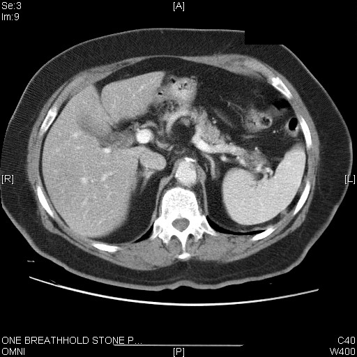 GU Radiologic Anatomy