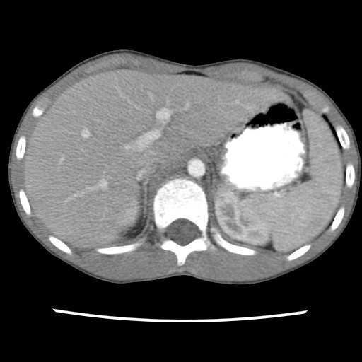 GU Radiologic Anatomy