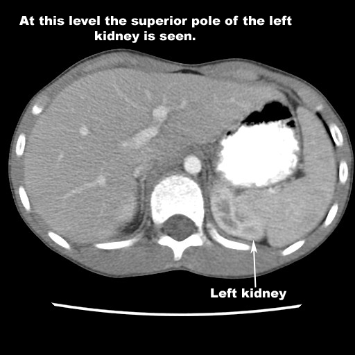 GU Radiologic Anatomy