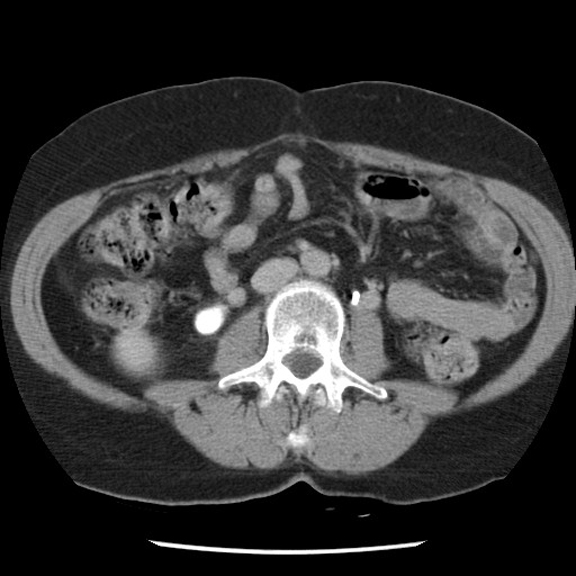 GU Radiologic Anatomy