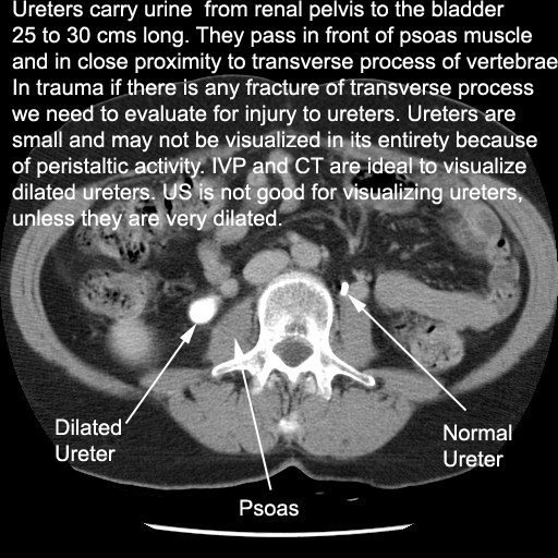 GU Radiologic Anatomy