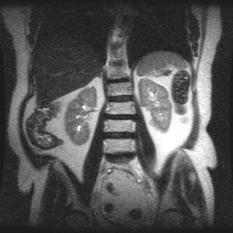 GU Radiologic Anatomy