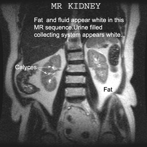 GU Radiologic Anatomy