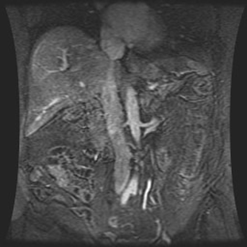GU Radiologic Anatomy