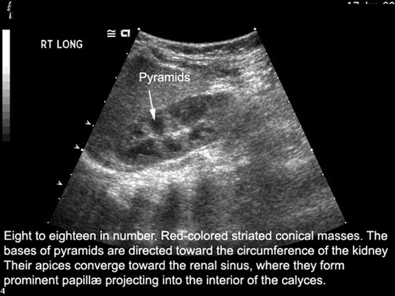 Try to identify the following