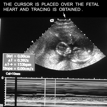 Image Atlas of Normal Pregnancy