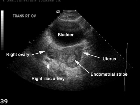 Pelvic Anatomy
