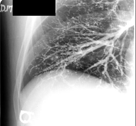Thorax Radiologic Anatomy
